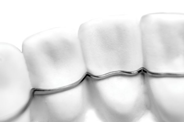 Memotain par Ormco : la contention pour tous vos cas - Ortho Autrement